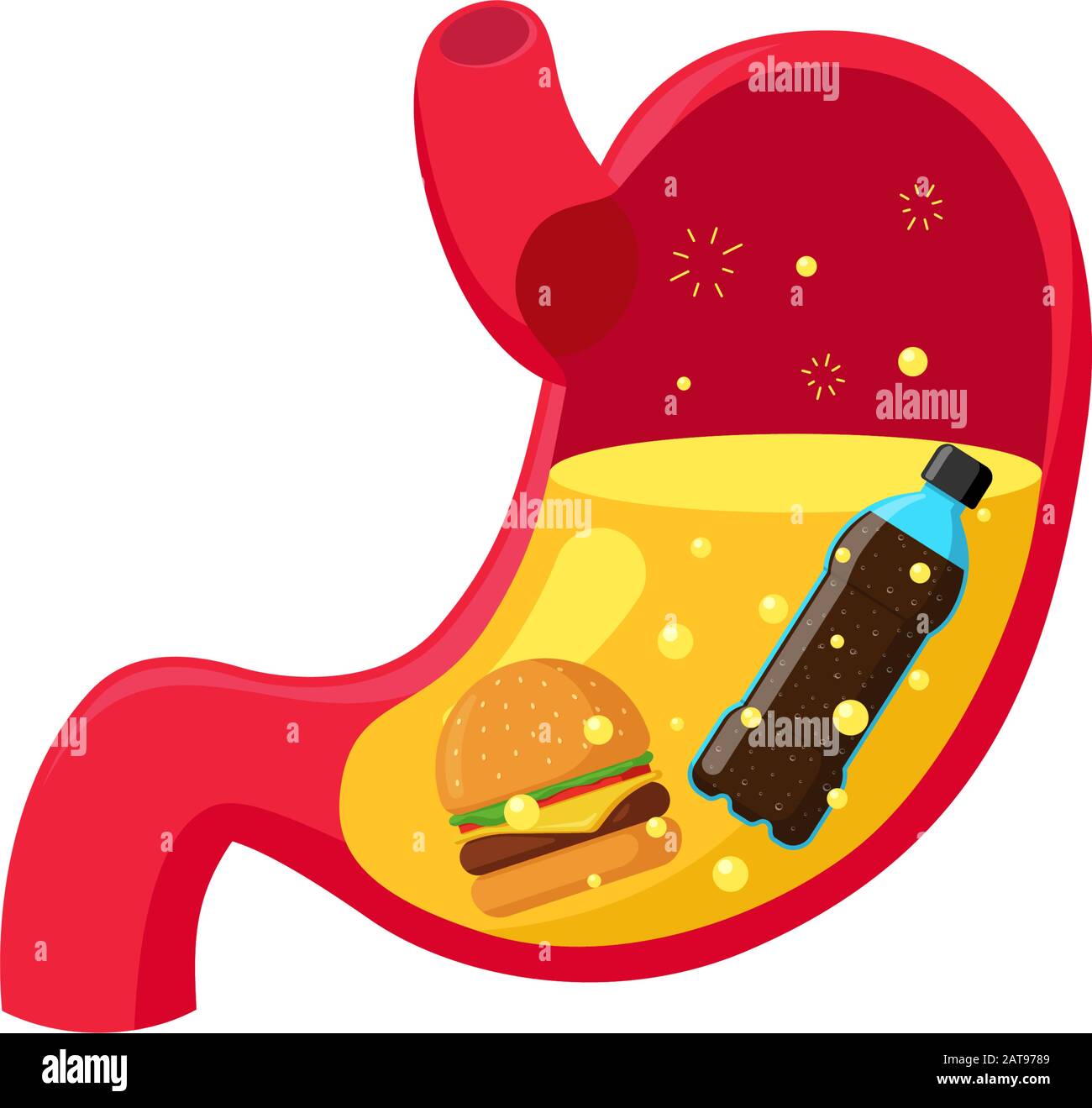 Manger malsain Fast food burger soda et jus gastrique dans l'estomac ...
