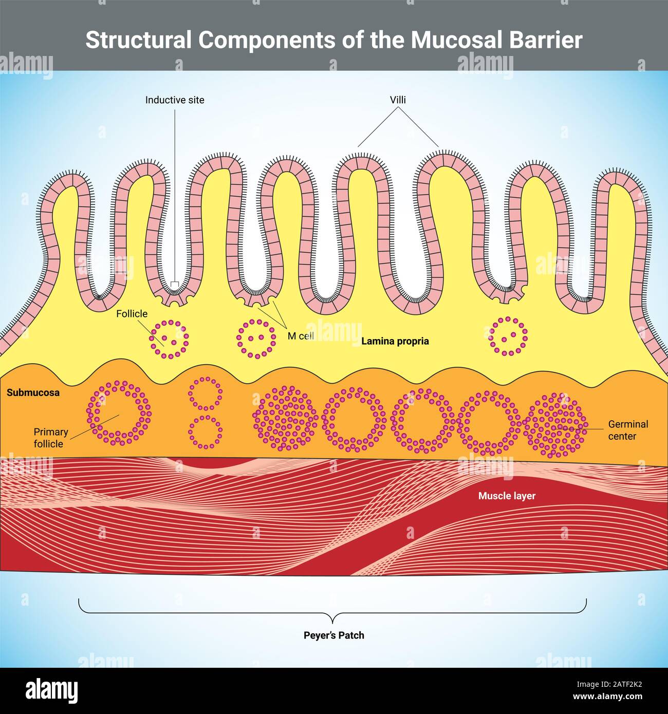 Maladie de la muqueuse Banque de photographies et d’images à haute ...