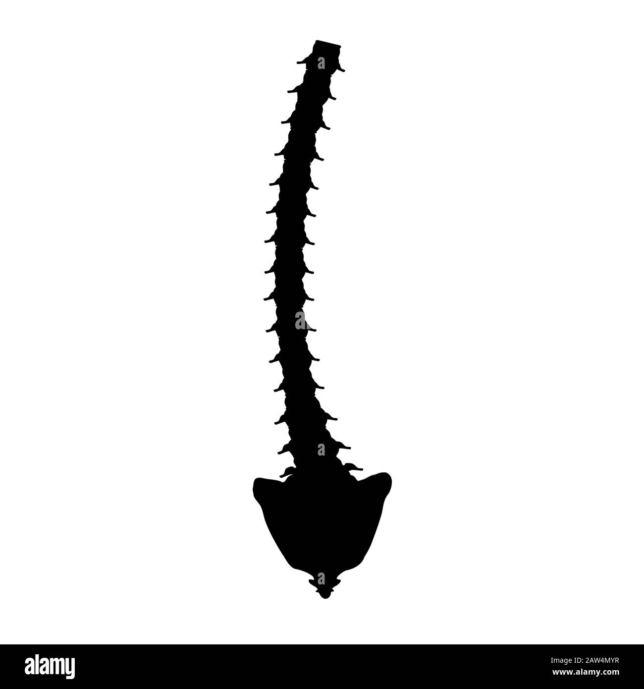 Icône silhouette noir et blanc la scoliose. La courbure de la colonne ...