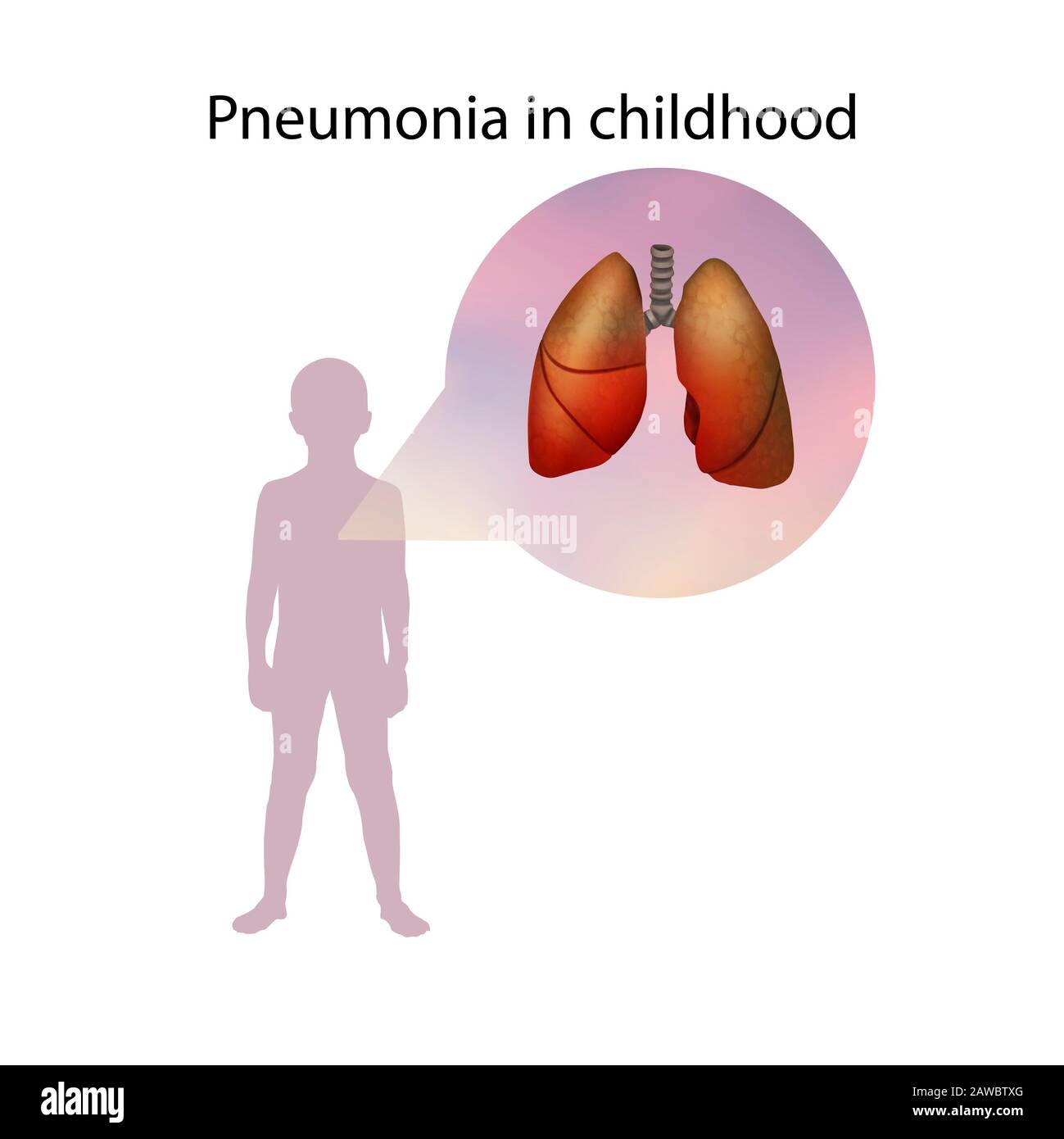 Anatomie pulmonaire de l'enfant Banque de photographies et d’images à ...