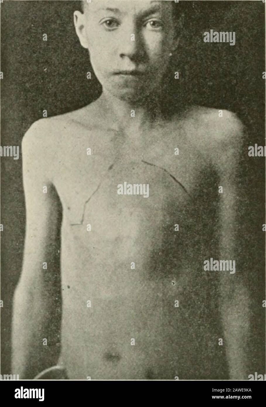 Maladies de la poitrine et les principes du diagnostic physique . Fig ...