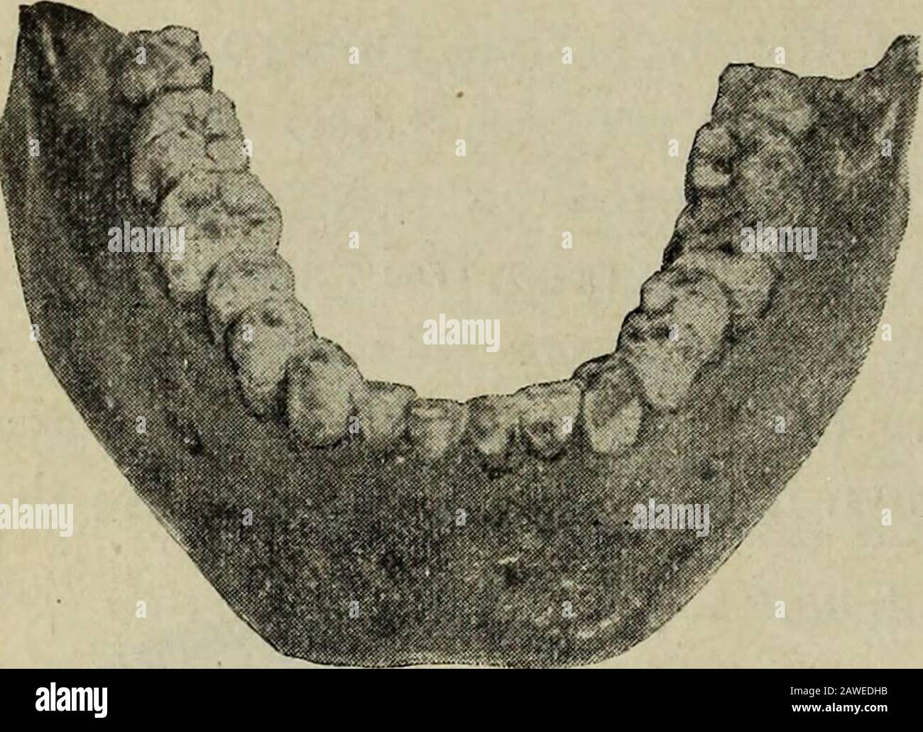 Os de machoire de chevreuil Banque de photographies et d’images à haute ...