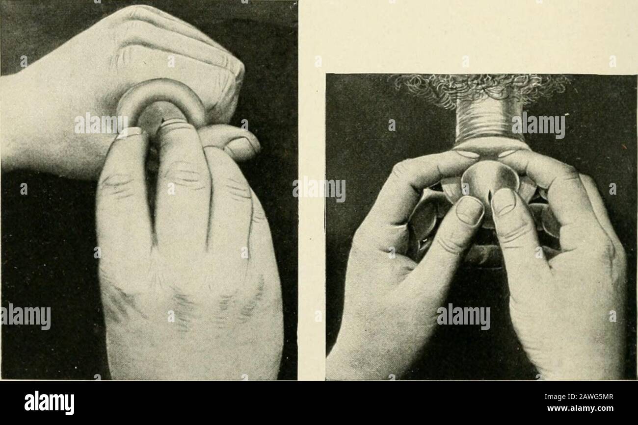 Prépuce Banque de photographies et d’images à haute résolution - Alamy