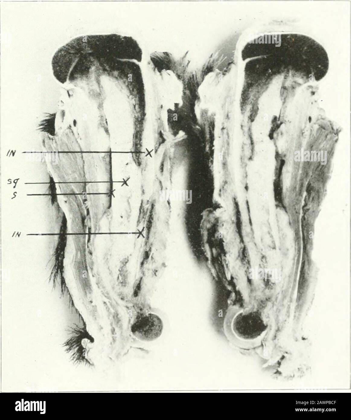 Types bone fractures Banque de photographies et d’images à haute ... Types bone fractures Banque de photographies et d’images à haute ...