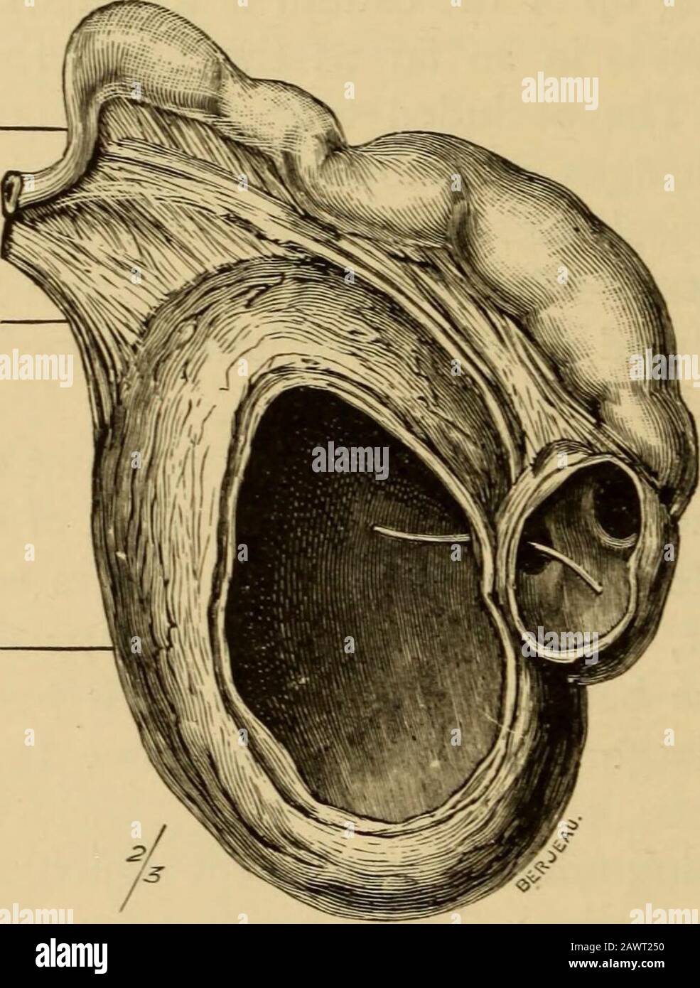 Anus women Banque de photographies et d’images à haute résolution - Alamy