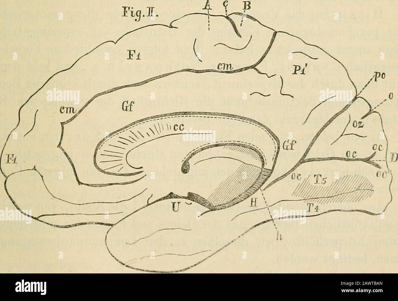 Handbuch der Kinderkrankheiten . ralis. Im Lobus parietalis P ...