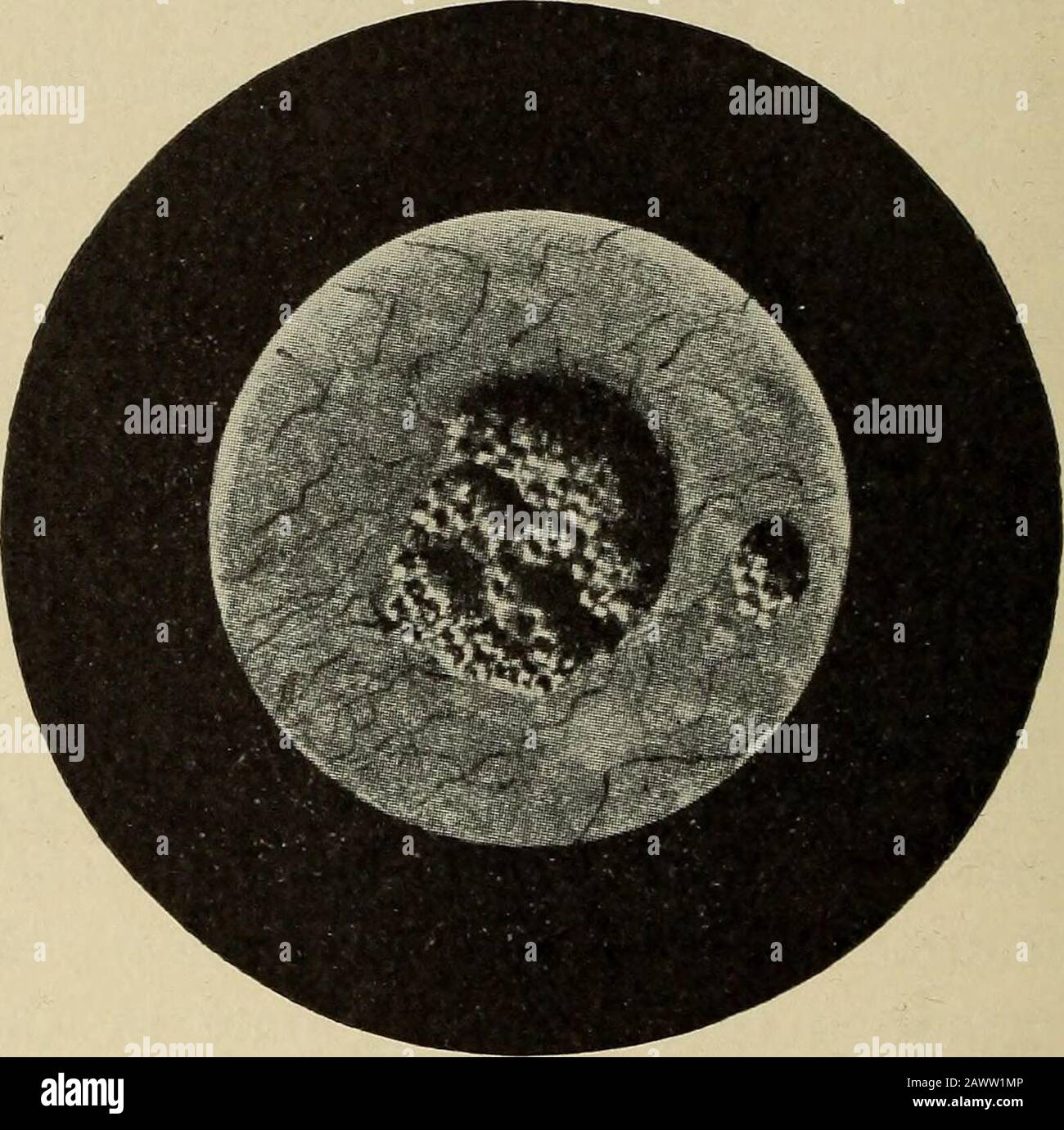 Diagnostic gynécologique . diagnostic ant caractéristique de l ...