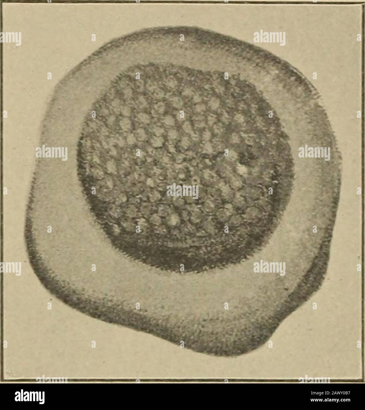 Canal cystique Banque de photographies et d’images à haute résolution ...