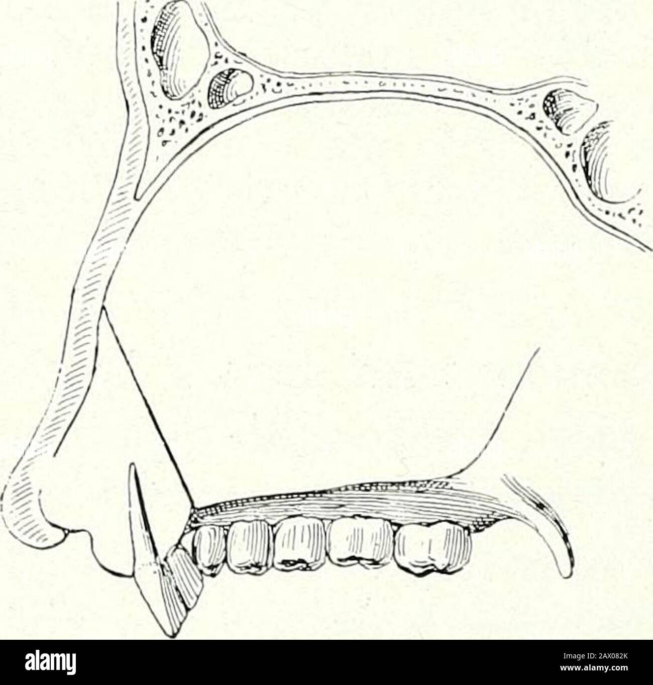 Cloison nasale Banque de photographies et d’images à haute résolution ...