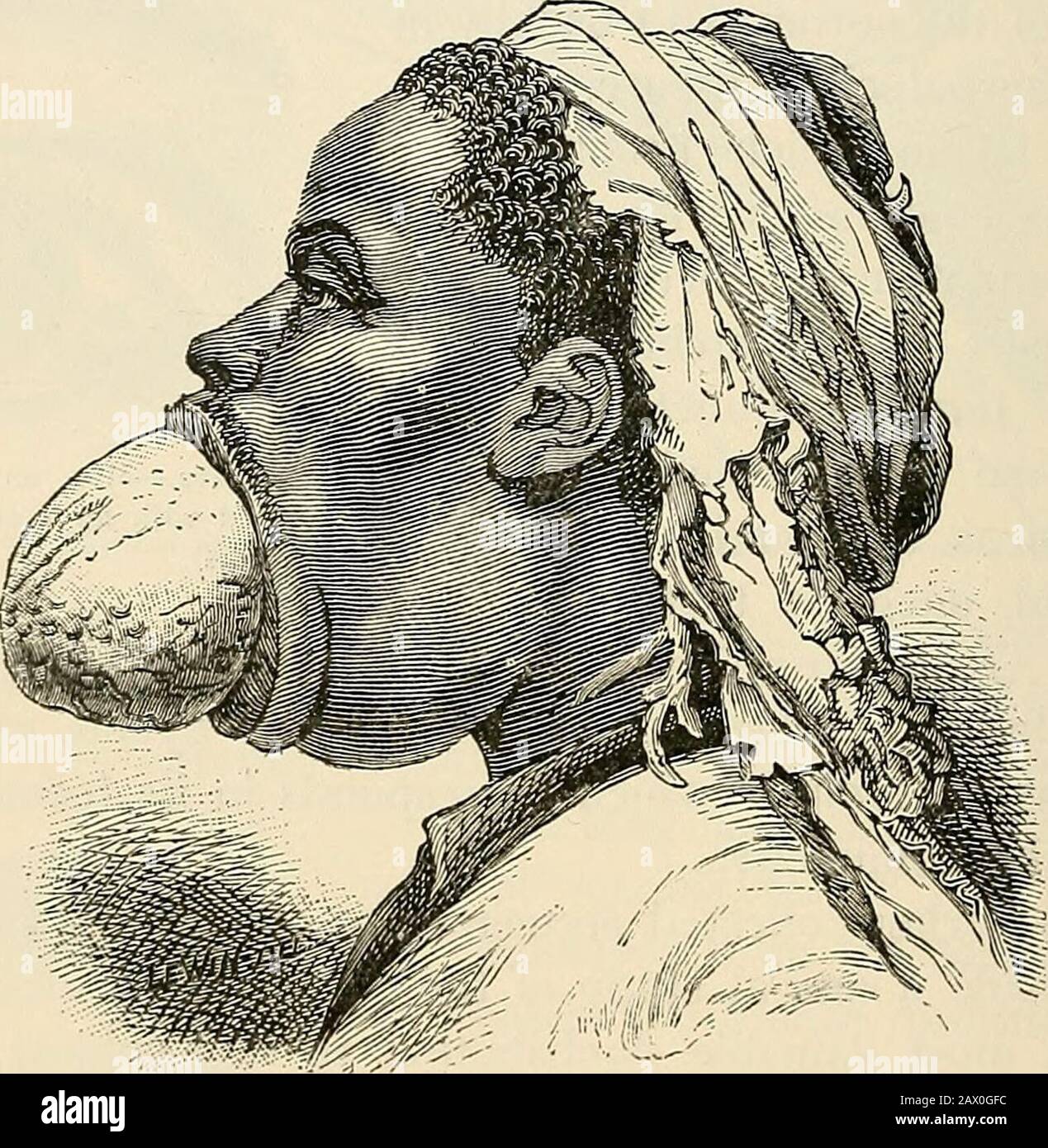 Caecum foramen Banque de photographies et d’images à haute résolution ...