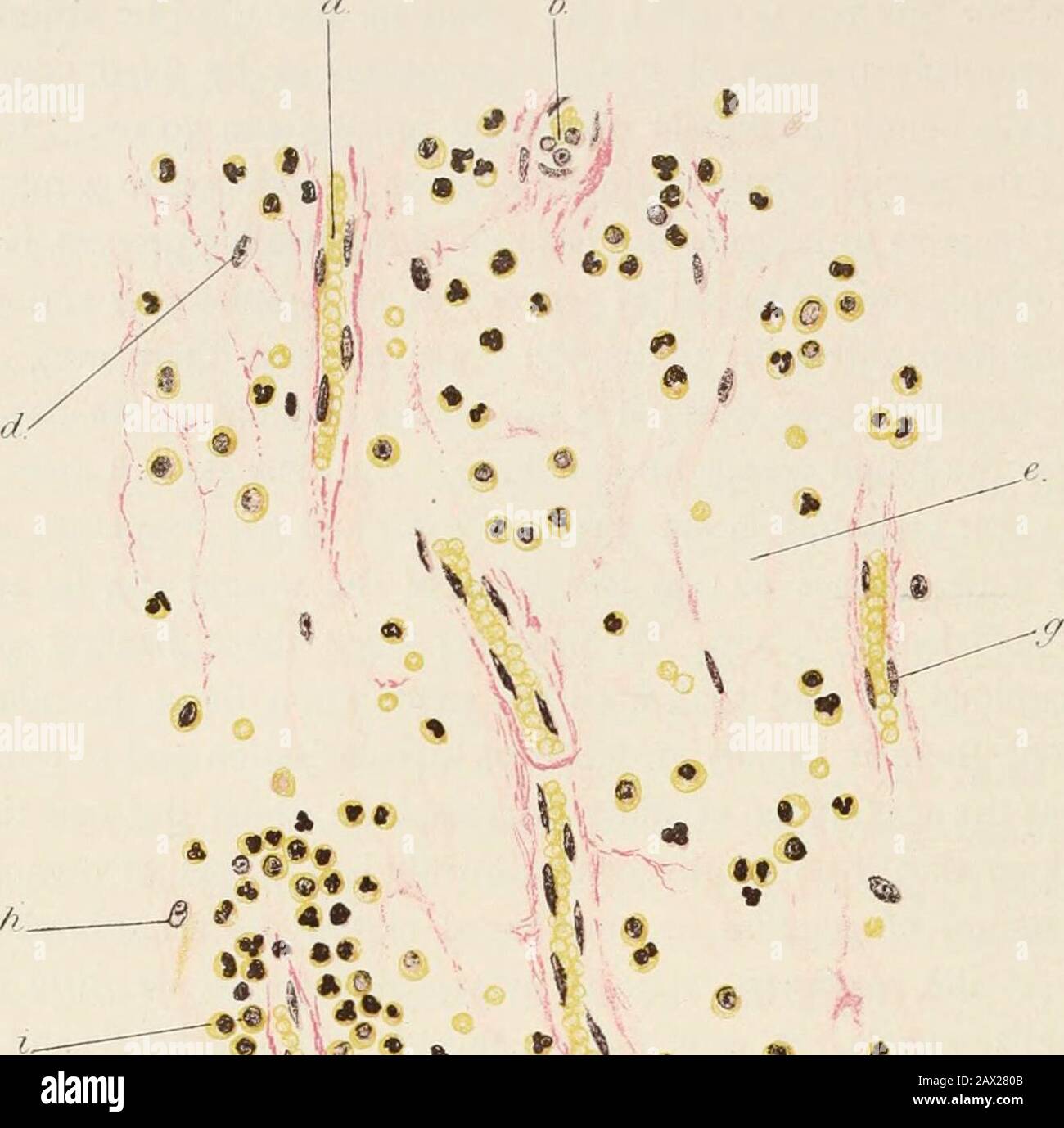 Tissu de granulation Banque de photographies et d’images à haute ...