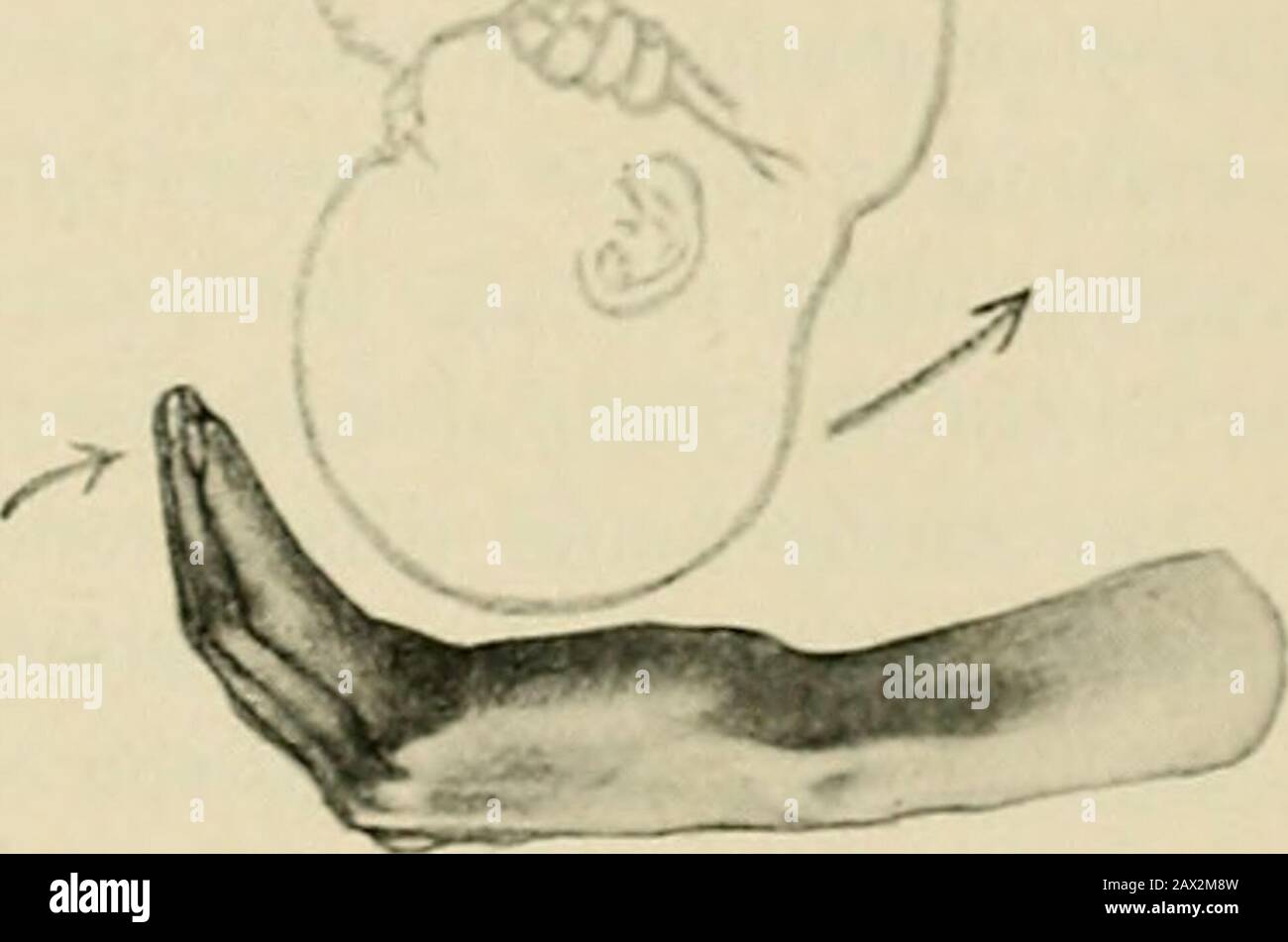 Présentation céphalique Banque de photographies et d’images à haute ...