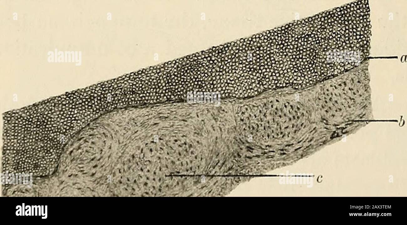 La pathologie et le traitement chirurgical des tumeurs . Fig. 317 ...