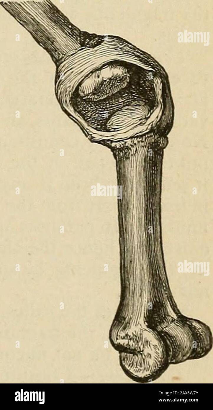 Chirurgie; sa théorie et sa pratique . résonner ensemble par tissu ...