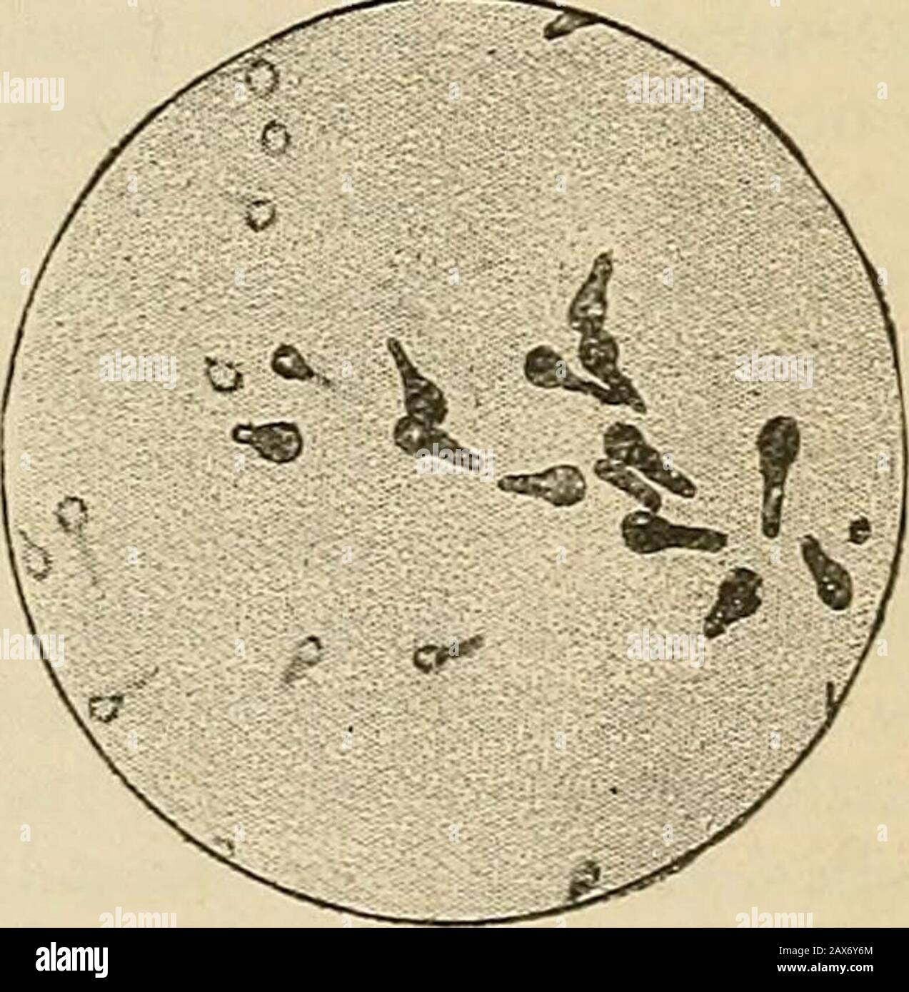 Tetanus bacillus Banque de photographies et d’images à haute résolution ...