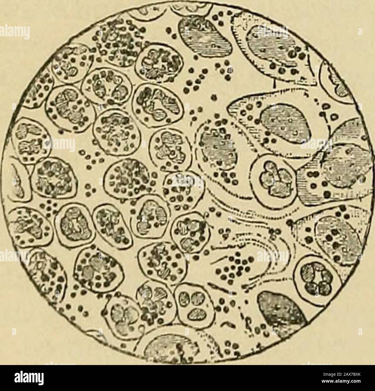 Chirurgie; sa théorie et sa pratique . reuset le Streptococcus pyogenes ...