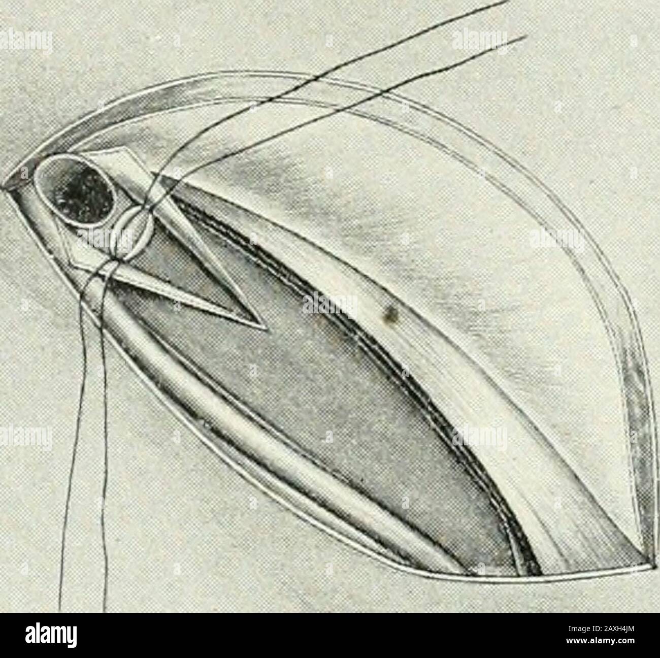 Inguinal canal Banque de photographies et d’images à haute résolution ...