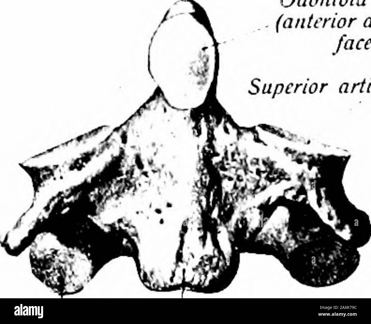 Un manuel d'anatomie . Processus transversal j Foramen transversarium ...