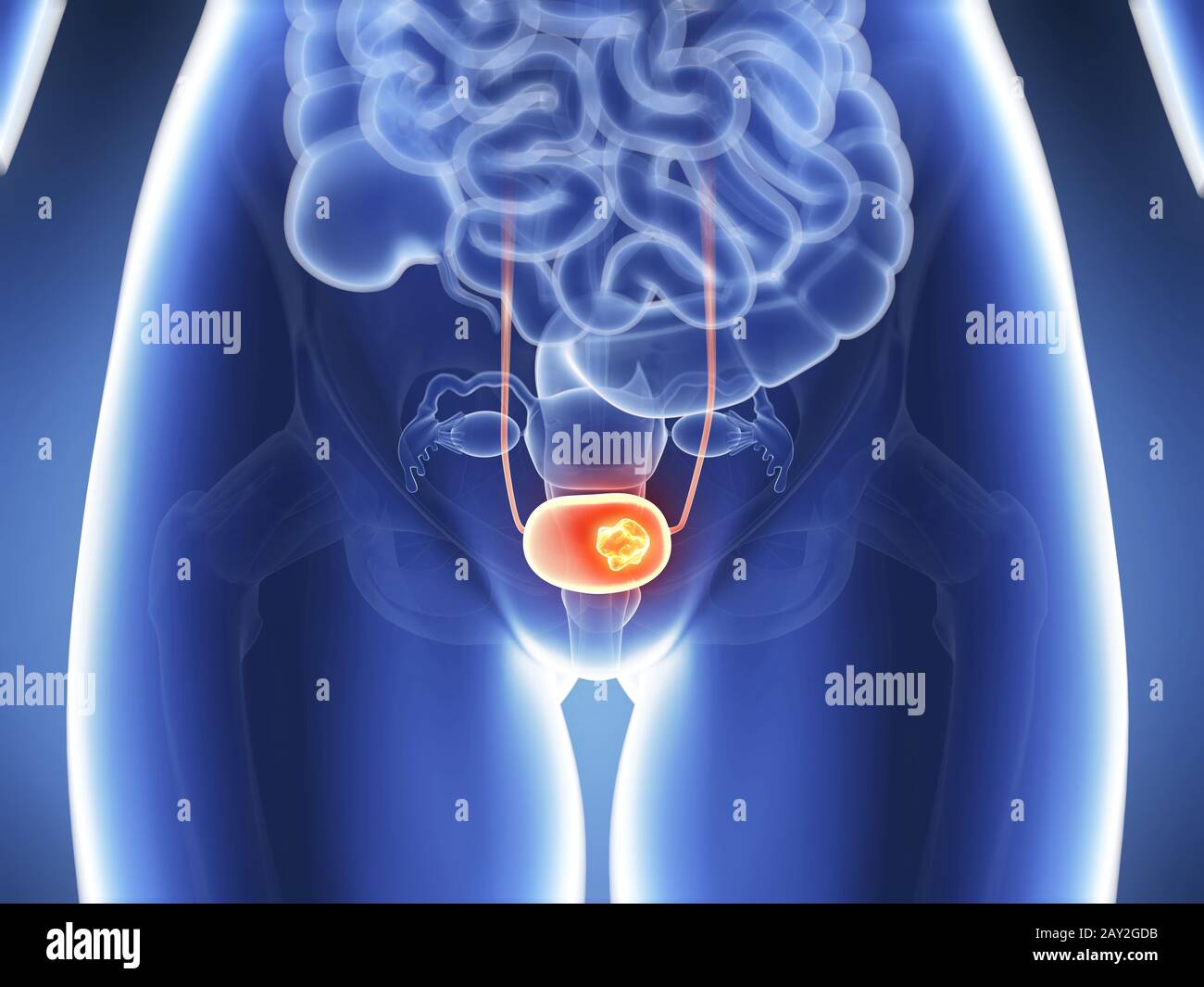 La Vessie Et La Prostate Banque De Photographies Et Dimages à Haute