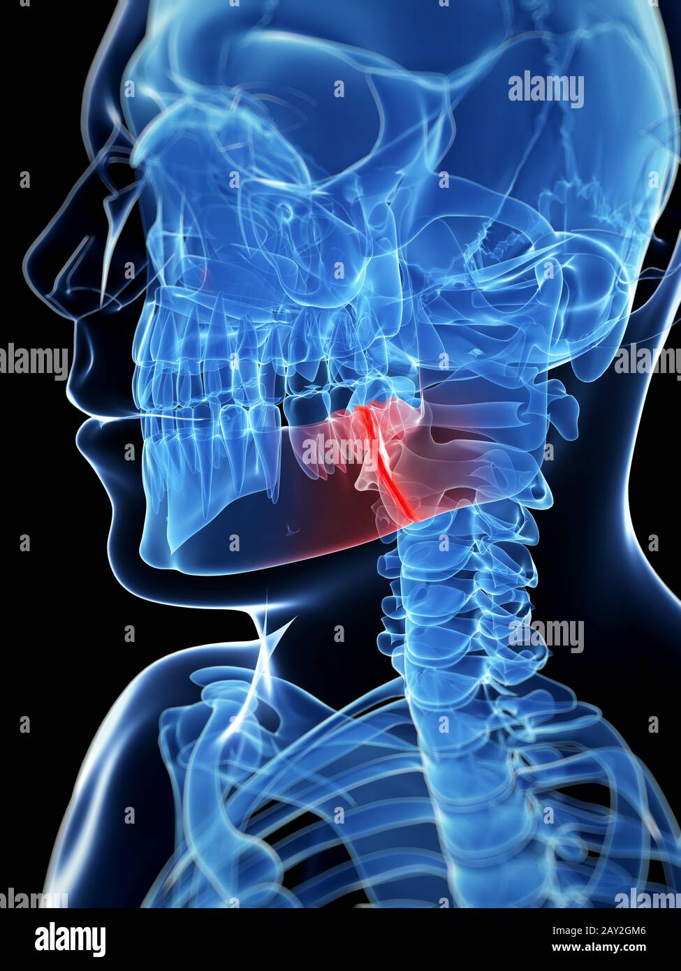 Geule cassée Banque de photographies et d’images à haute résolution - Alamy