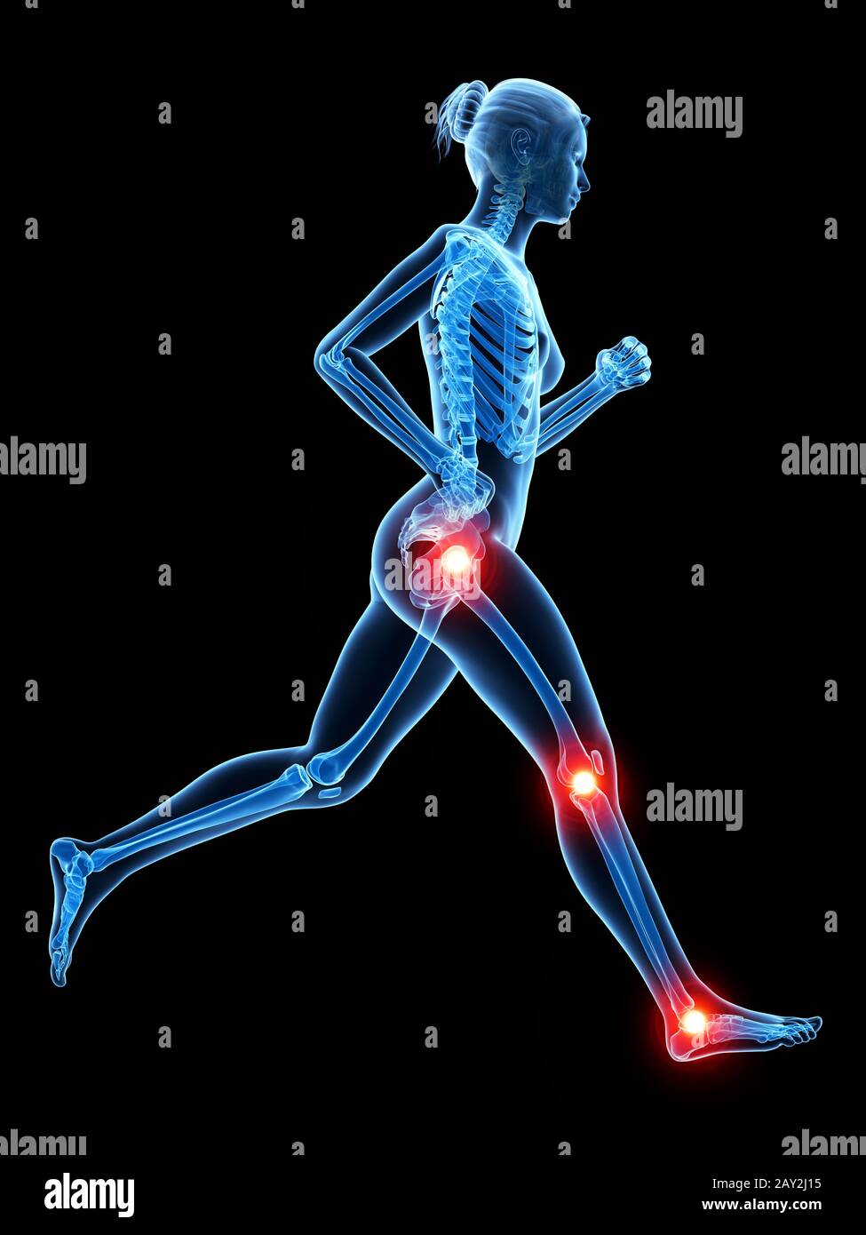 Articulations douloureuses de la hanche humaine Banque de photographies ...