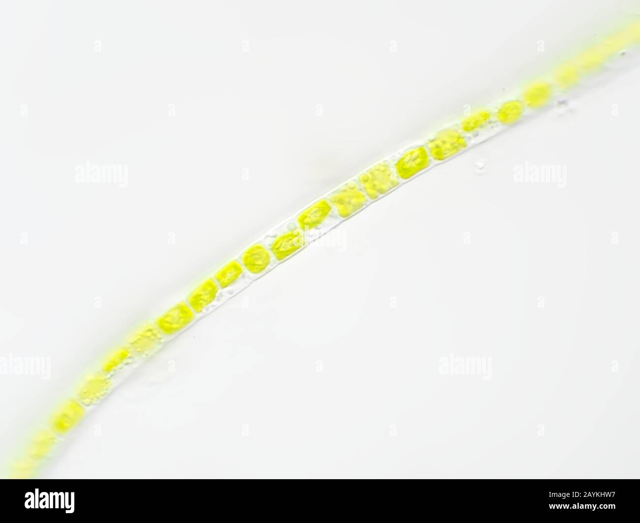 Algues vertes au microscope Banque de photographies et d’images à haute ...