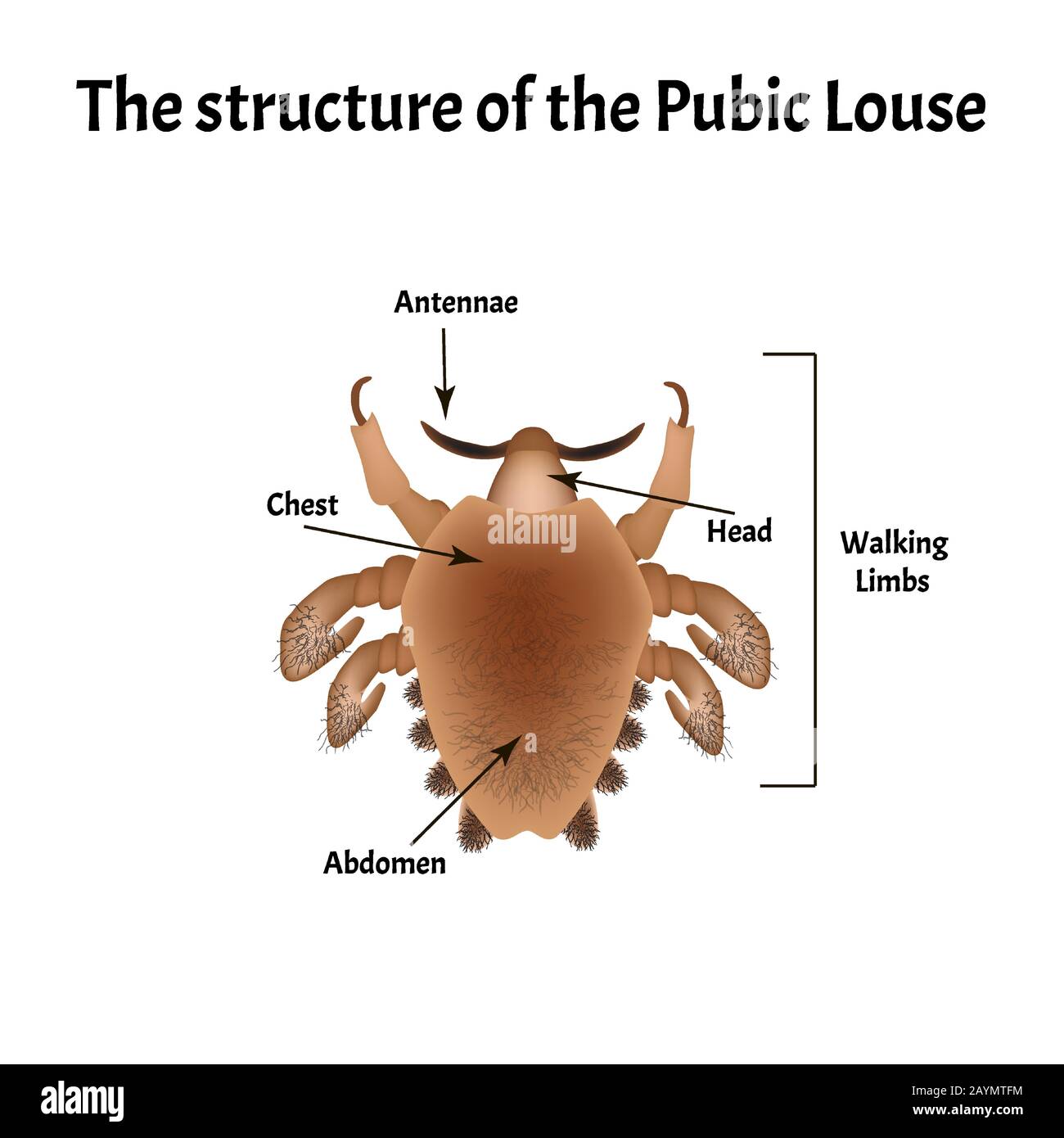 Photos De Poux Du Pubis