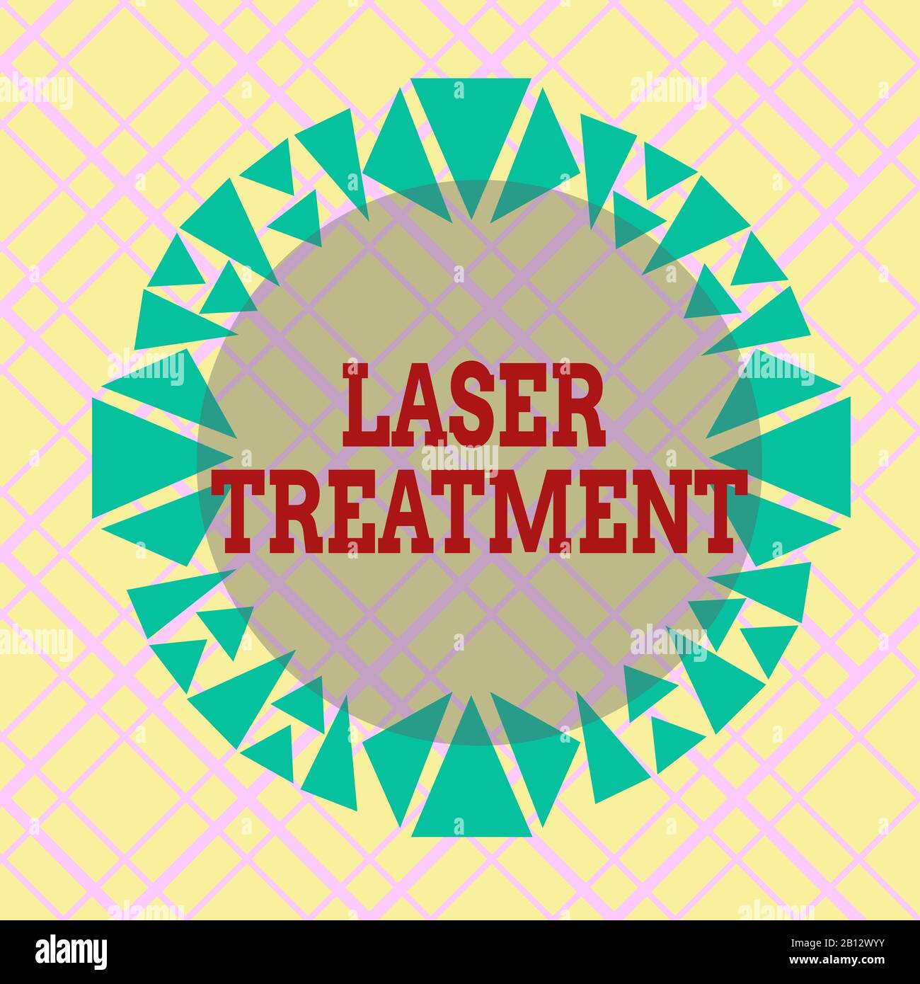 Note d'écriture montrant le traitement laser. Concept commercial pour l ...