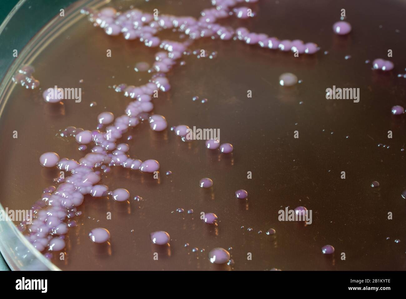 Macconkey agar plate Banque de photographies et d’images à haute ...