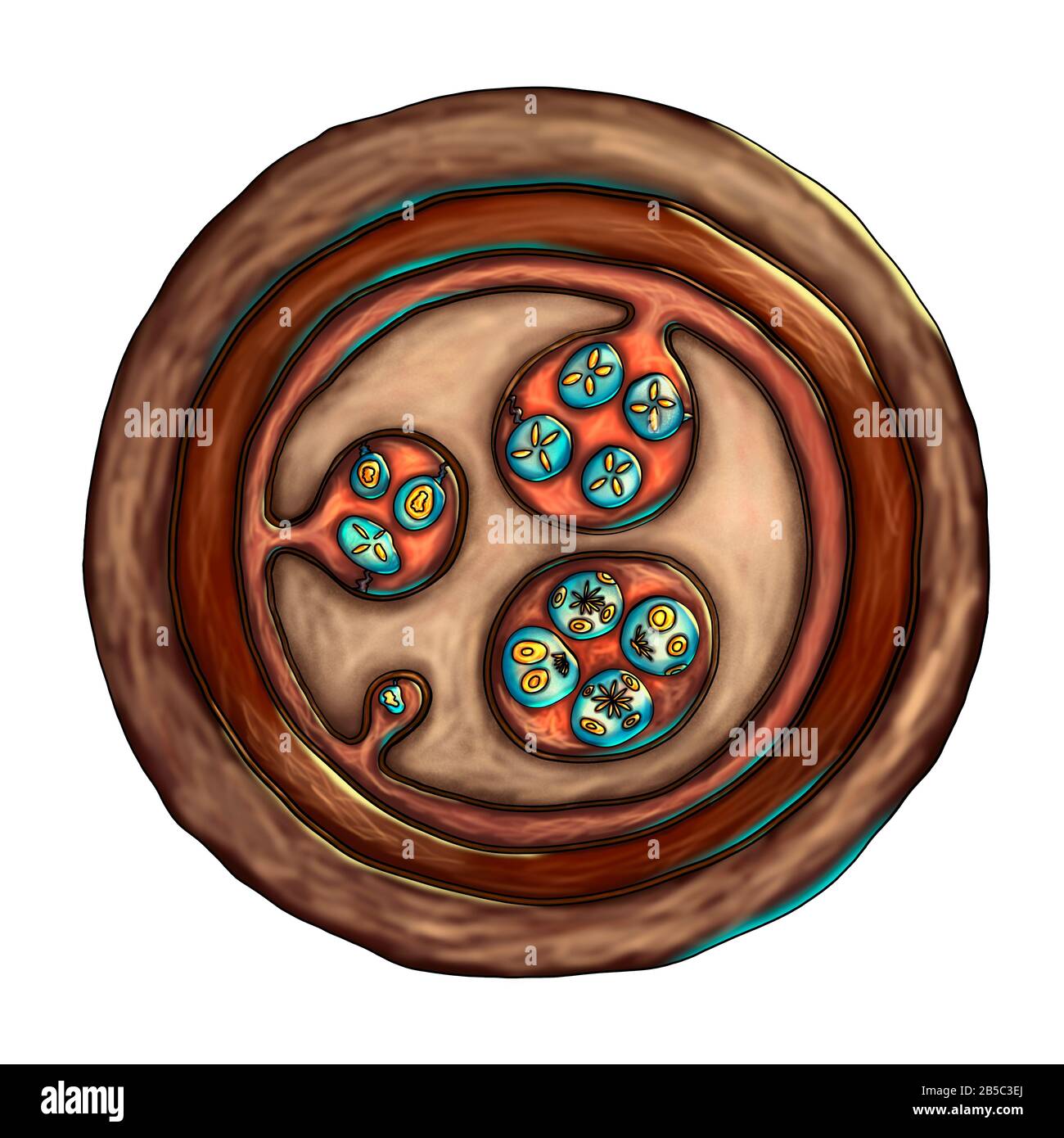 Hydatid cyst Banque de photographies et d’images à haute résolution - Alamy