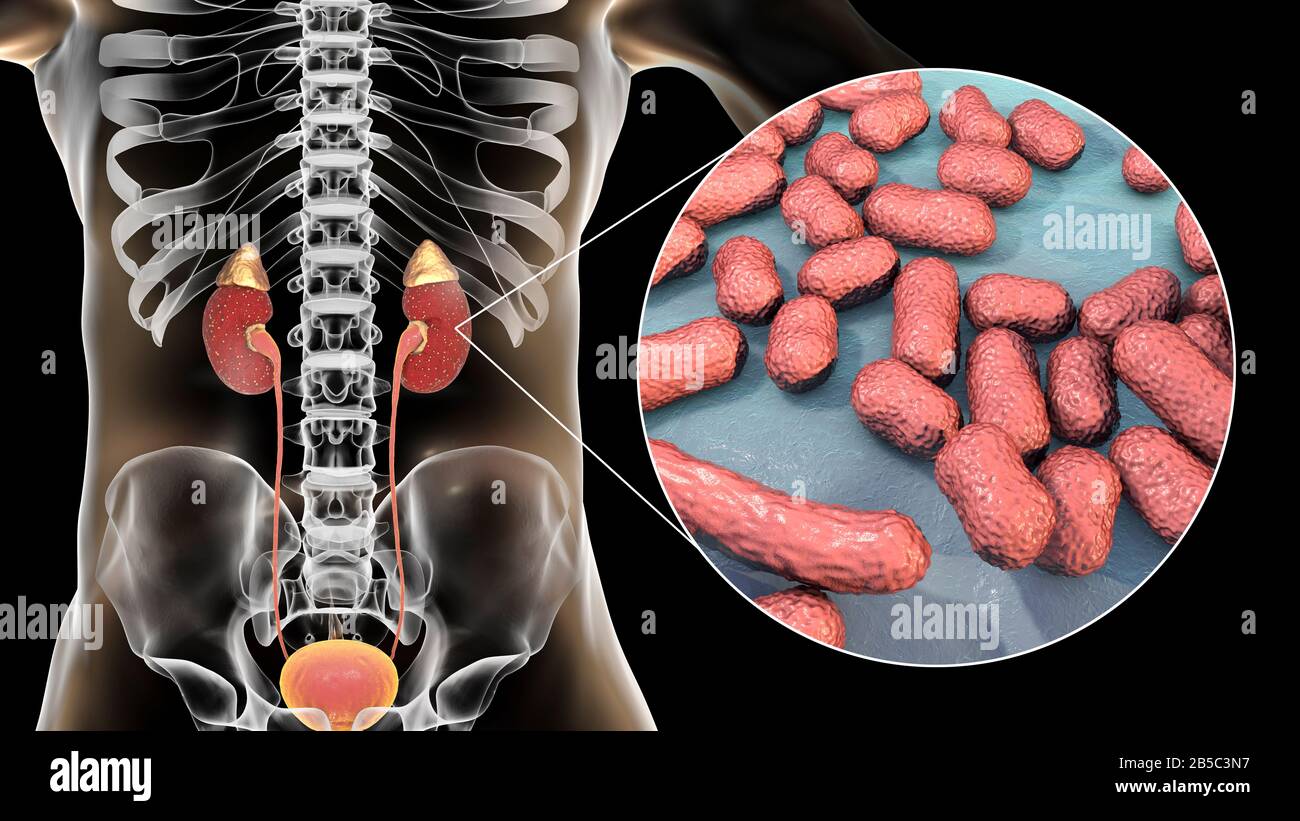 Bacterias acinetobacter baumannii Banque de photographies et d’images à ...