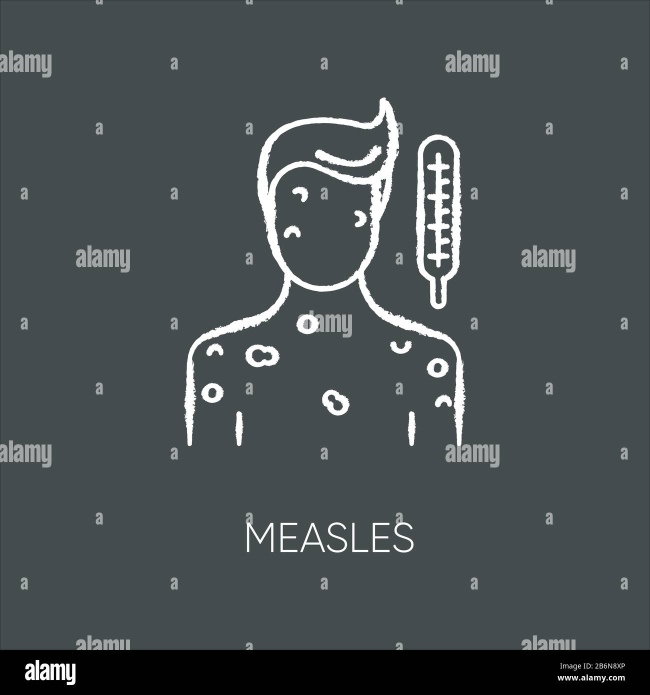 Infection par le virus de la rougeole Banque d'images noir et blanc - Alamy