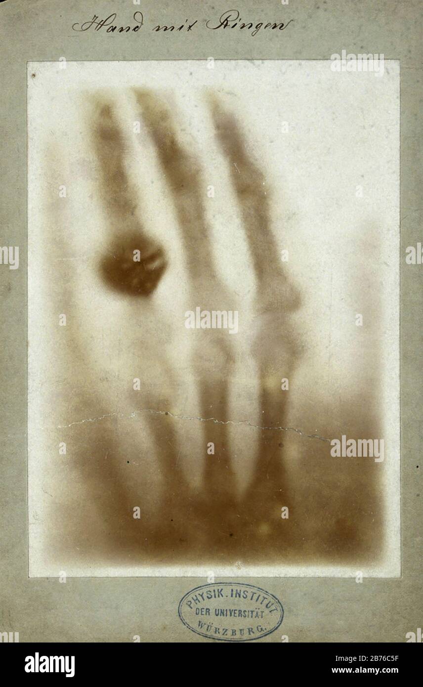 Radiographie de rontgen Banque de photographies et d’images à haute ...