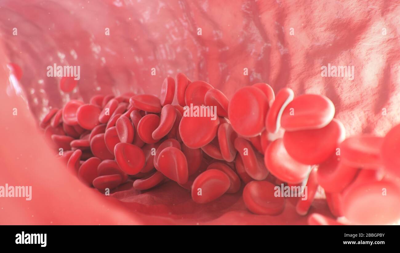 Caillot de sang dans une veine artère Banque de photographies et d ...
