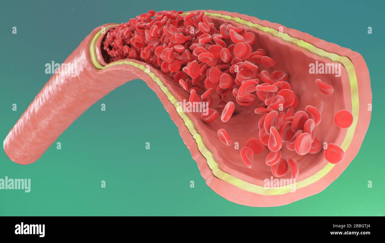 Coeur anatomique rouge 3d Banque de photographies et d’images à haute ...