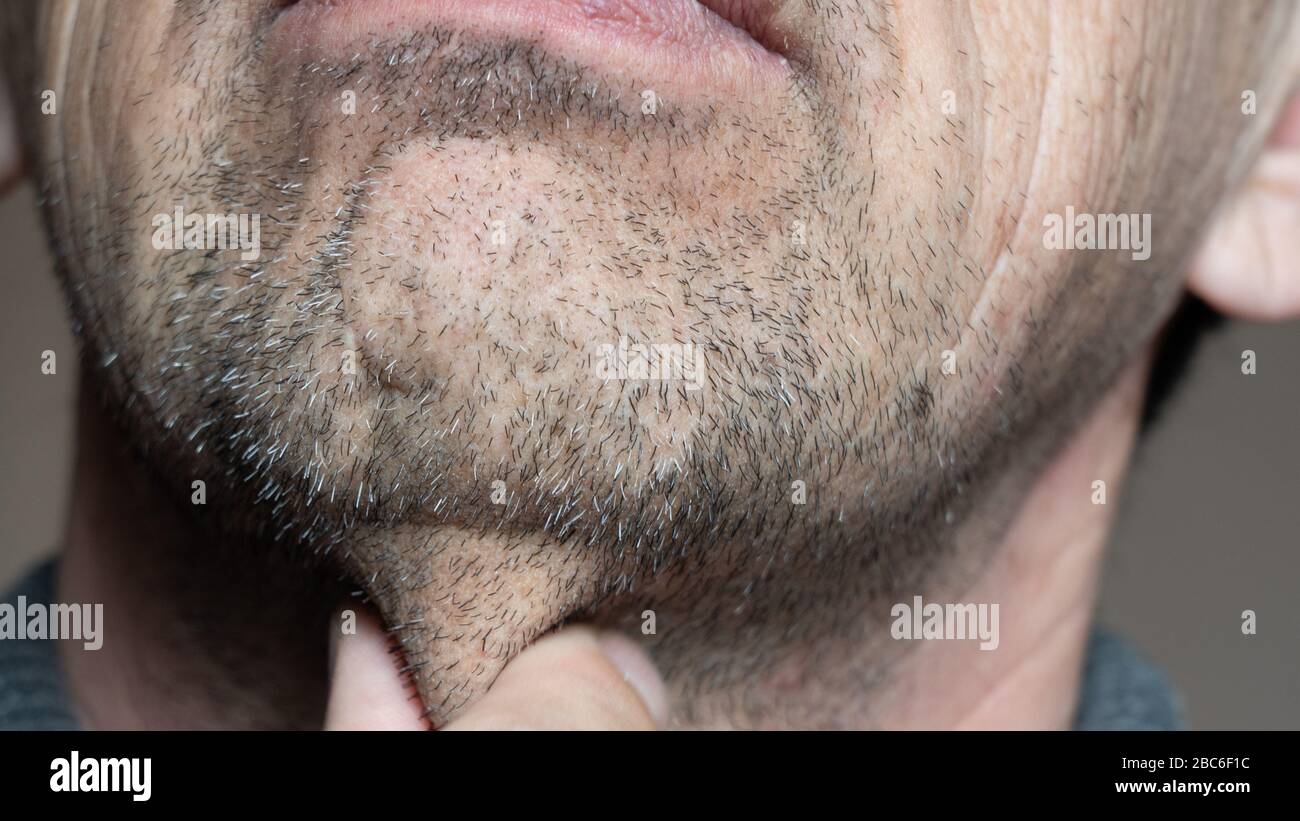 Barbe mal rasée Banque de photographies et d’images à haute résolution ...