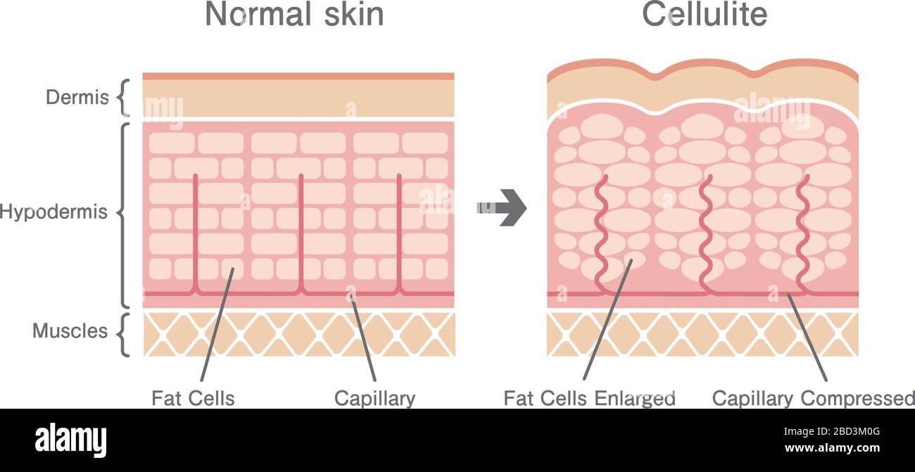 Fat tissue Banque d'images vectorielles - Alamy