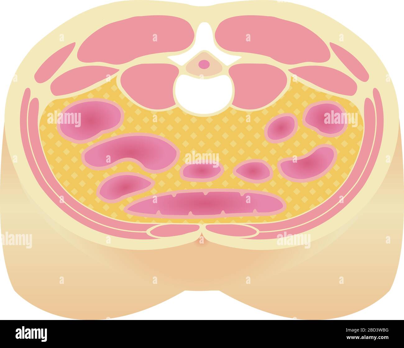 Obesity illustration Banque d'images vectorielles - Alamy