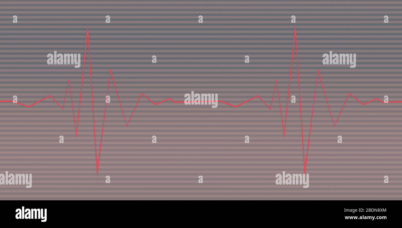 Courbe de battements cardiaques sur un électrocardiogramme ECG du ...