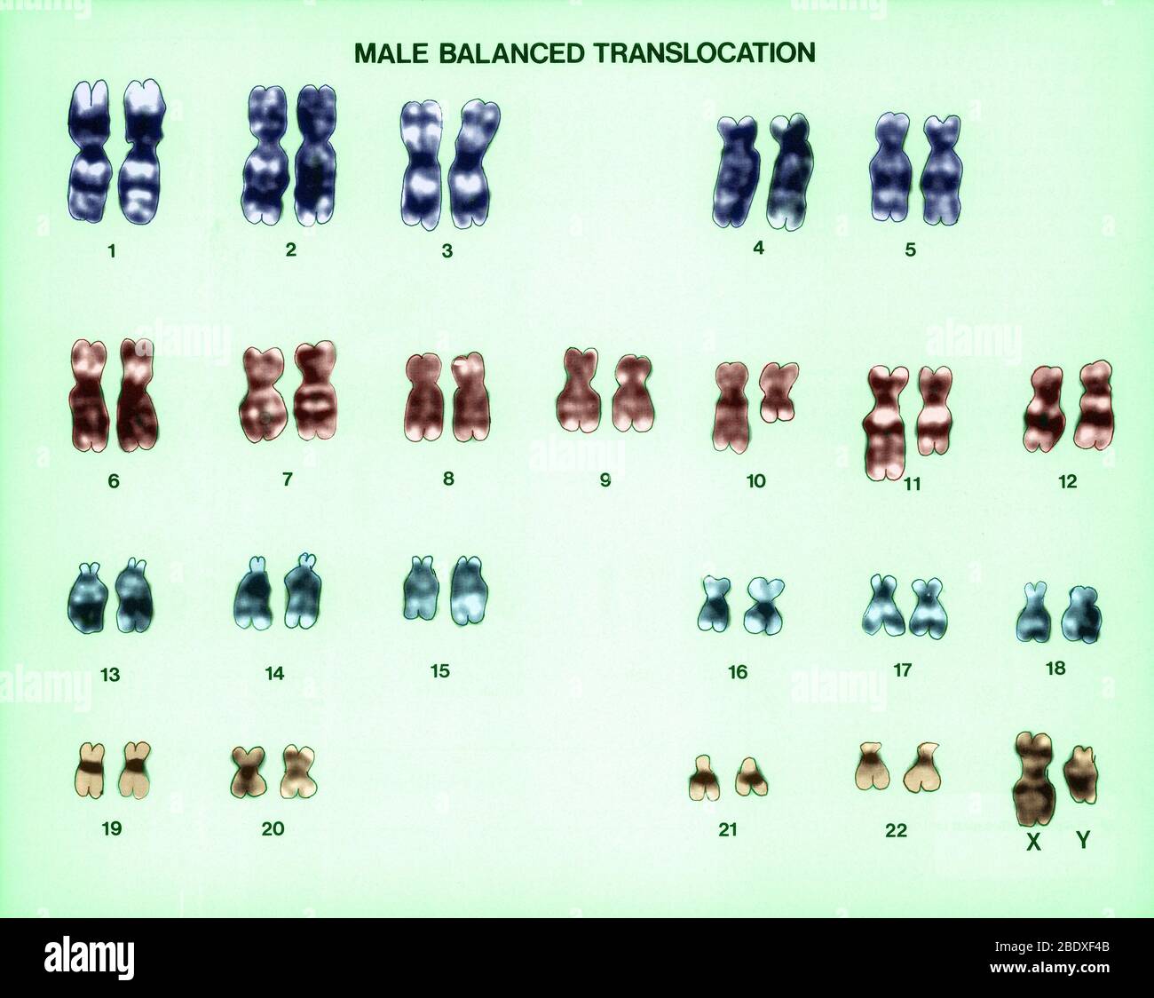 Karyotype Male Banque De Photographies Et Dimages à Haute Résolution