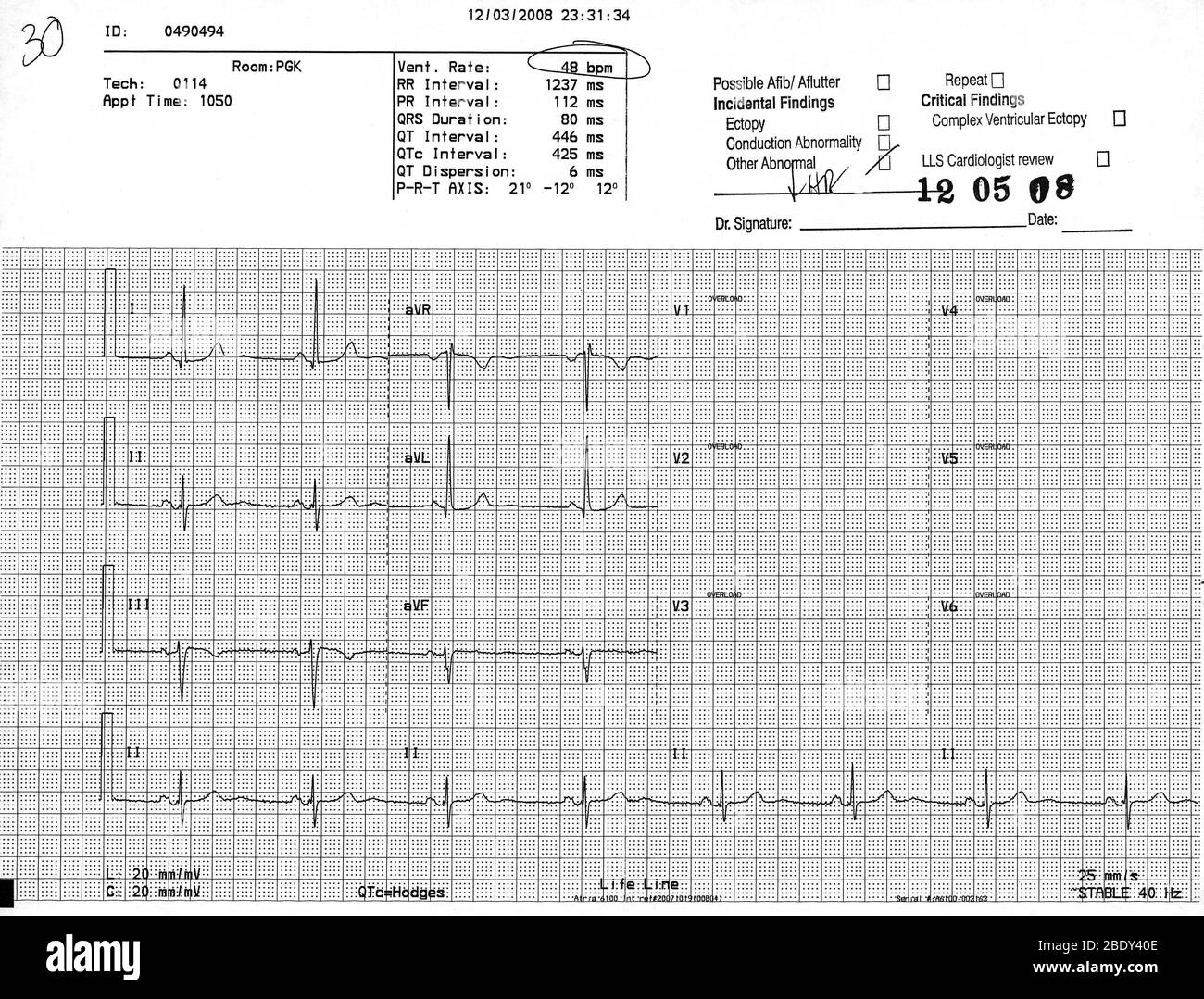Normal ecg Banque de photographies et d’images à haute résolution - Alamy