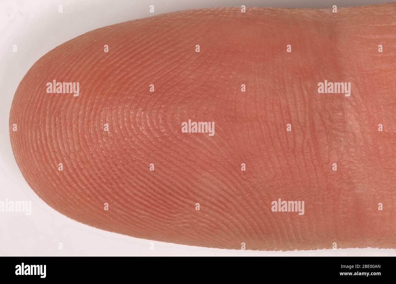 Skin ridges Banque de photographies et d’images à haute résolution - Alamy