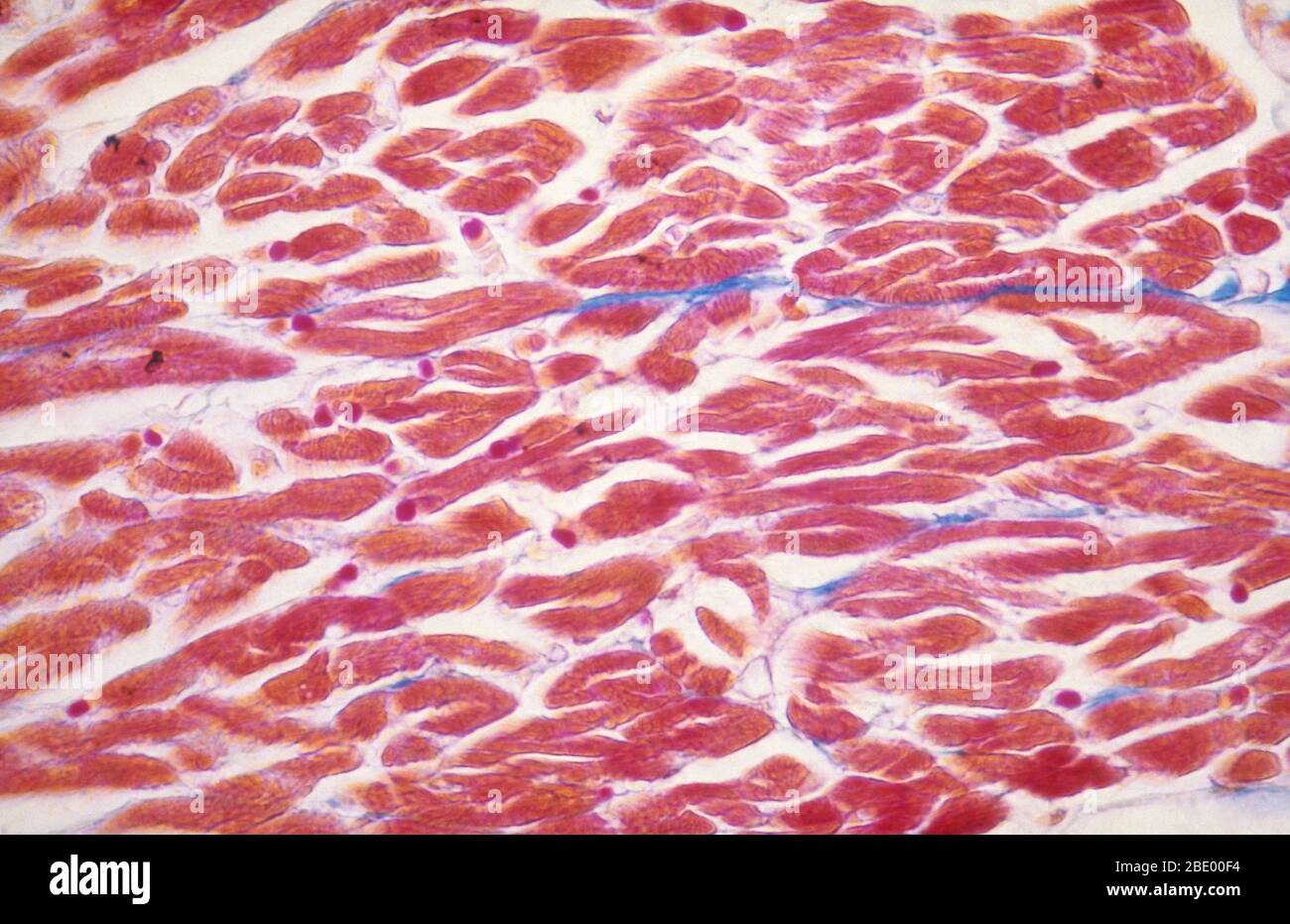 Cardiac muscle tissue Banque de photographies et d’images à haute ...