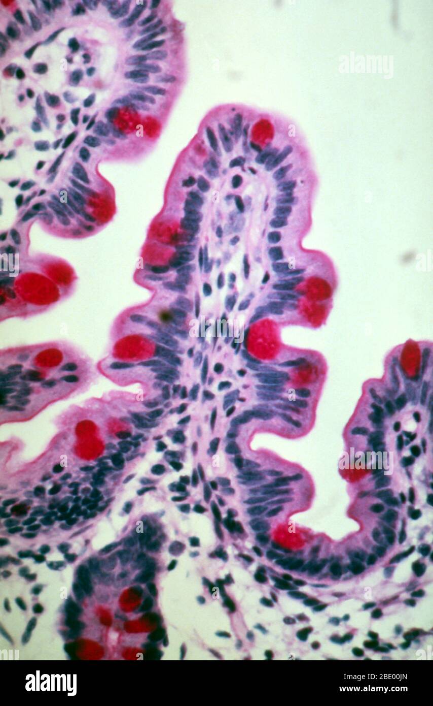Paroi de l'intestin Banque de photographies et d’images à haute ...
