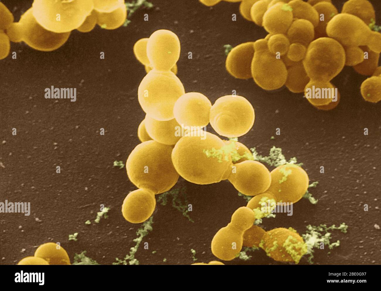 Micrographe électronique à balayage (SEM) de Malassezia furfur, une ...