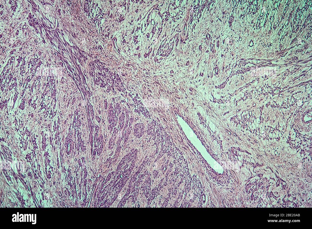 Uterus histology Banque de photographies et d’images à haute résolution ...