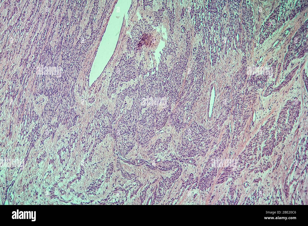 Uterus histology Banque de photographies et d’images à haute résolution ...