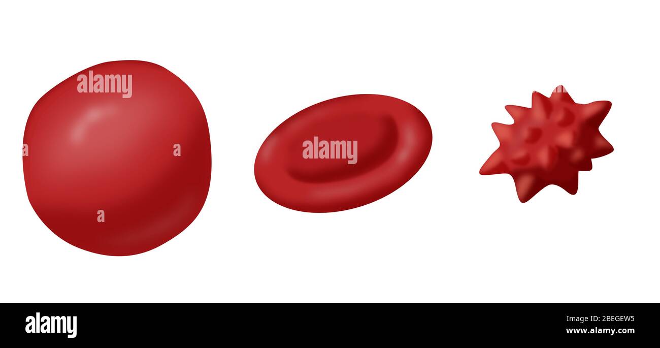 Pression osmotique sur les cellules sanguines Banque de photographies ...