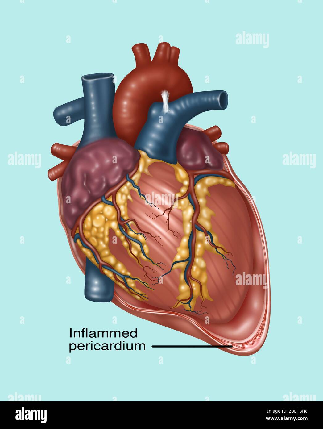 Péricarde coeur Banque de photographies et d’images à haute résolution ...