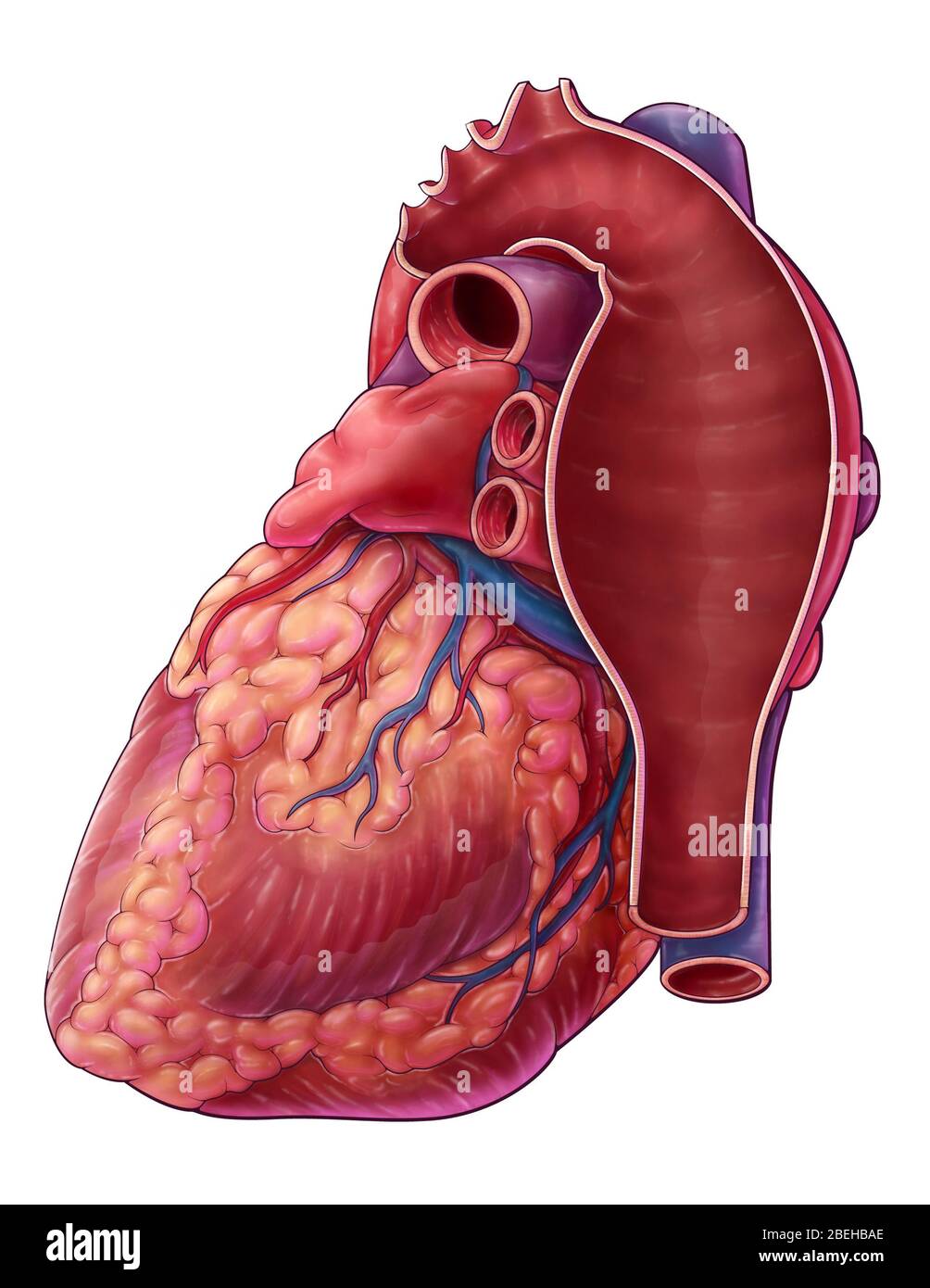 Anévrisme aortique thoracique, illustration Photo Stock - Alamy